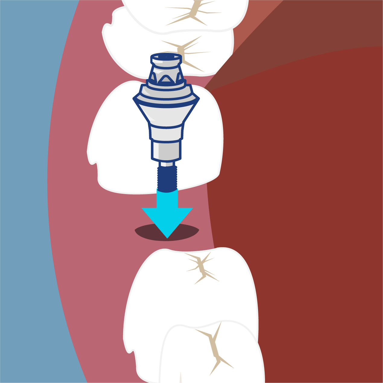 About — RODO Digital Prosthetics Inc.