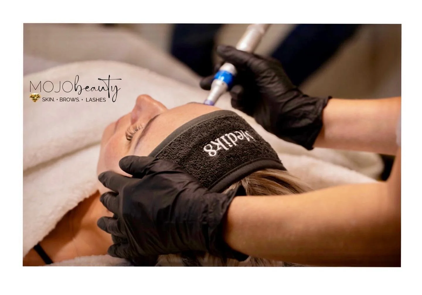 Micro-Dermal Needling | Mojo Beauty Skin, Brows & Lashes Fendalton ...