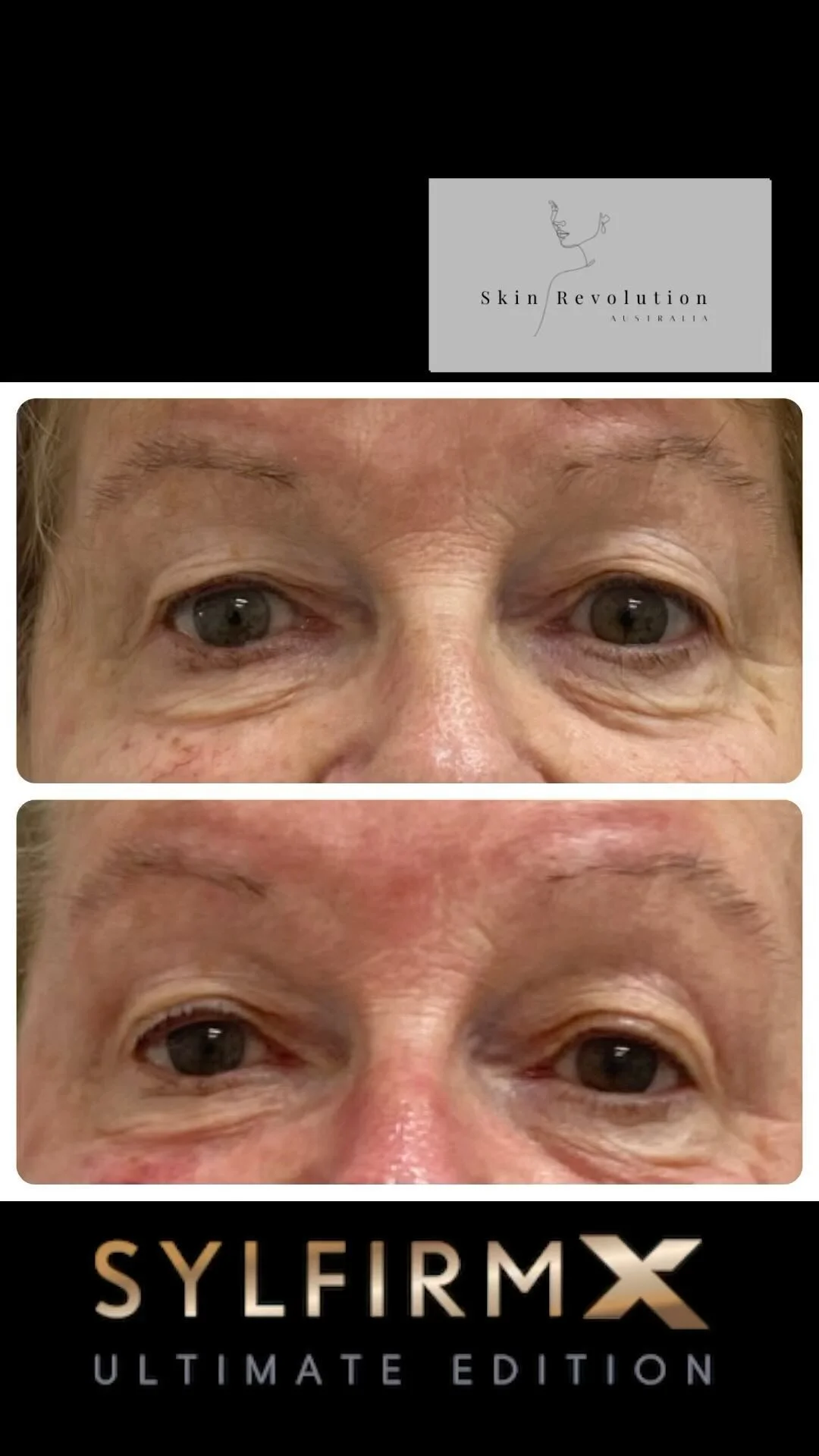 Skin Revolution Australia