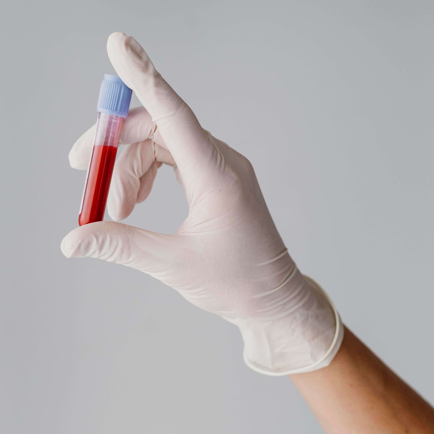 Vitamin IV therapy Infusions | Intra-V | The Woodlands | Katy, TX
