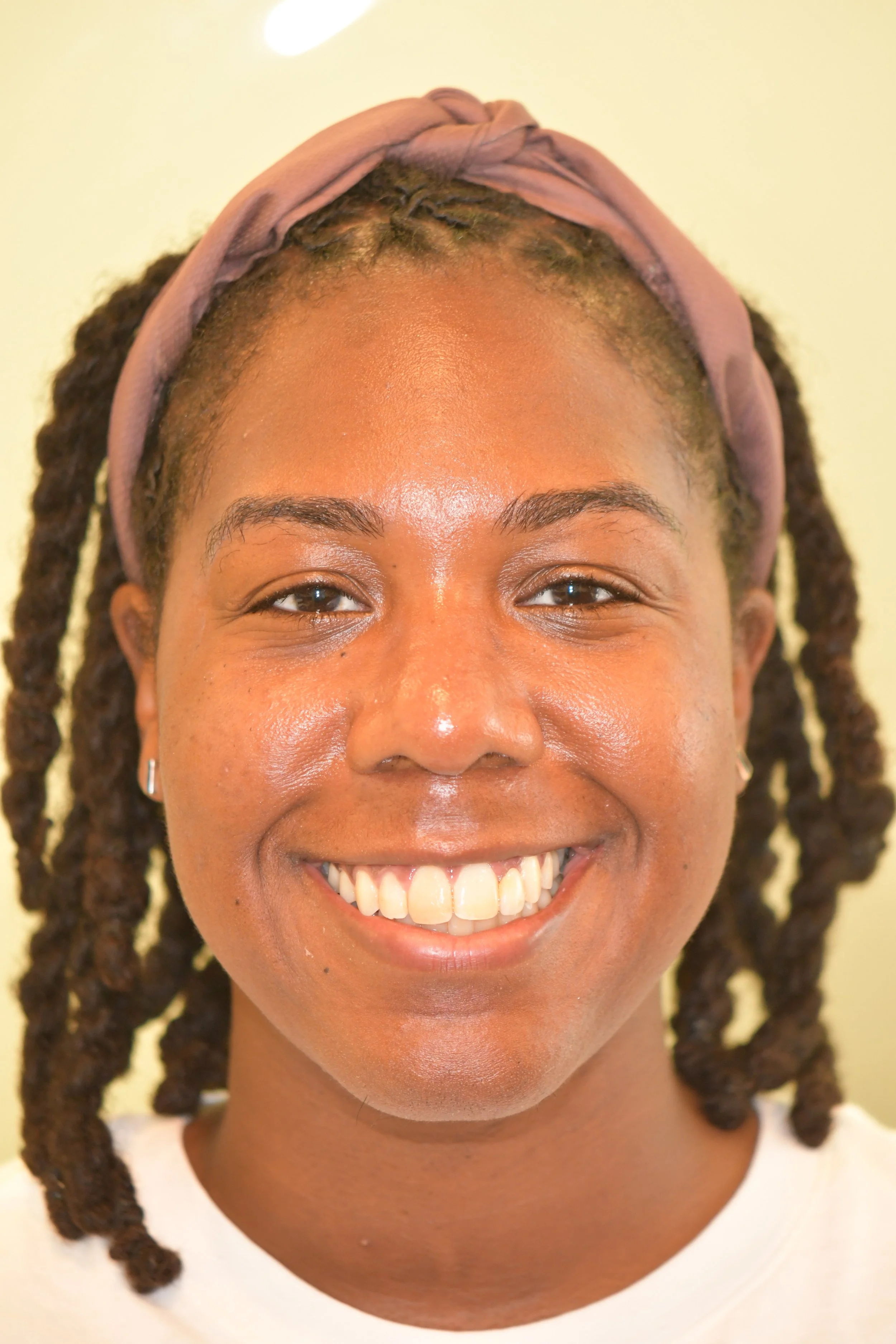 Maxillary Skeletal Expansion (MSE) - How It Works