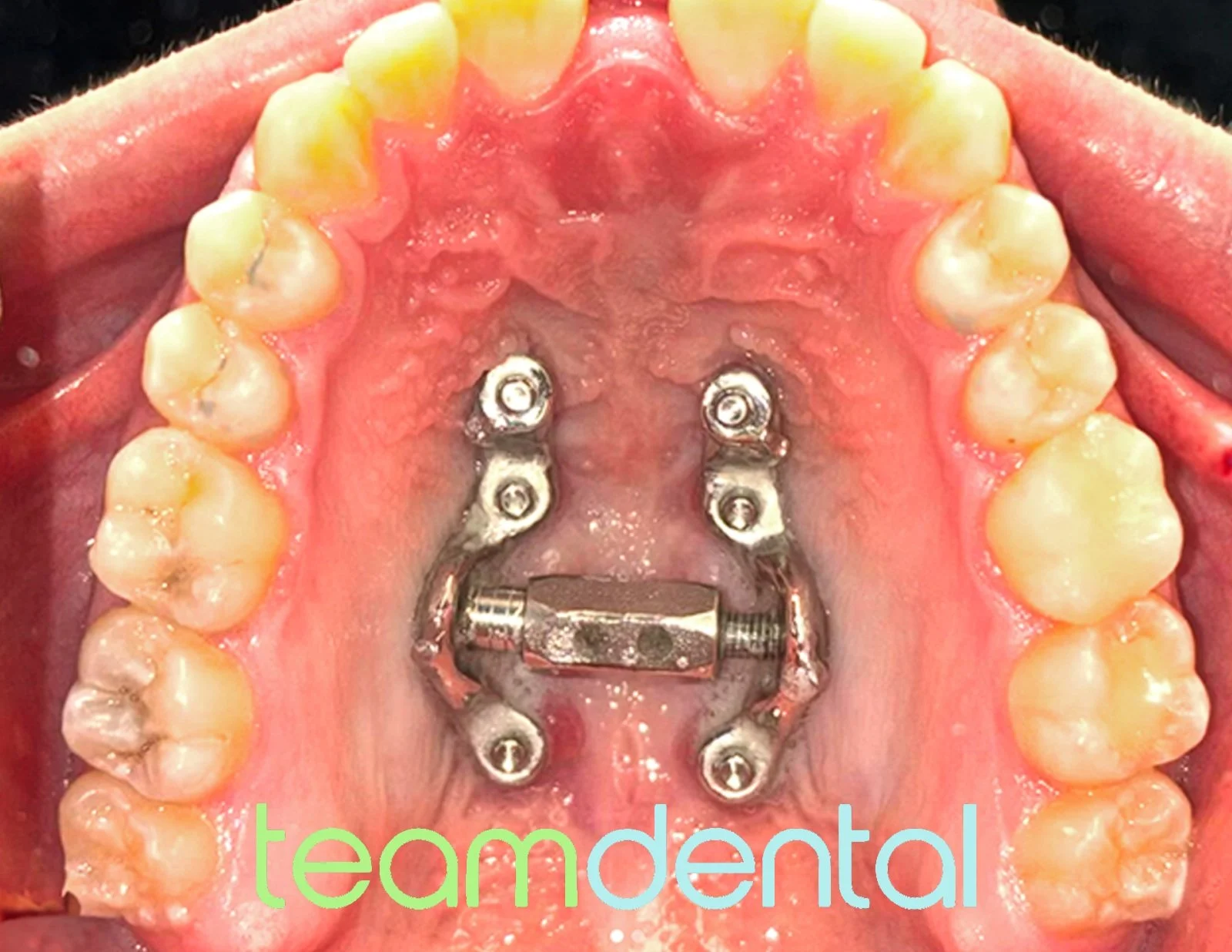 Team Dental: Dentist serving Philadelphia & Swedesboro, NJ