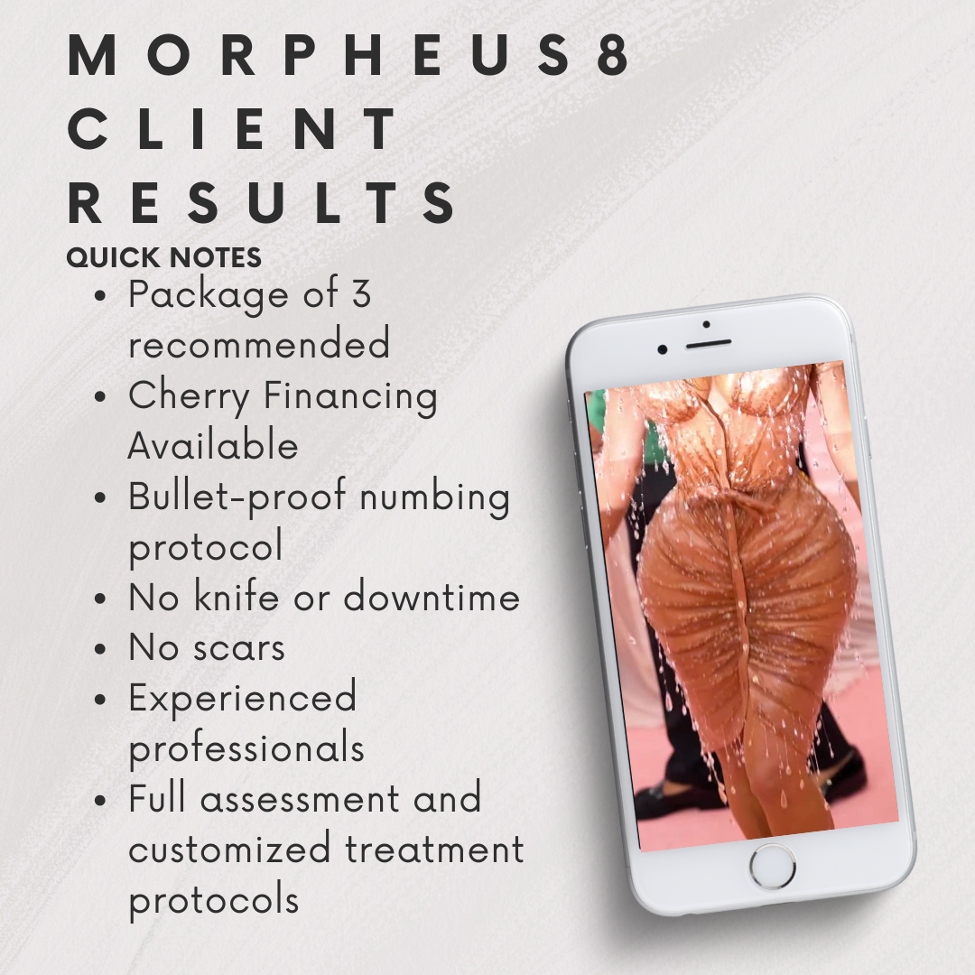 Morpheus8 by InMode | Denver, CO — Denver Dream Medspa