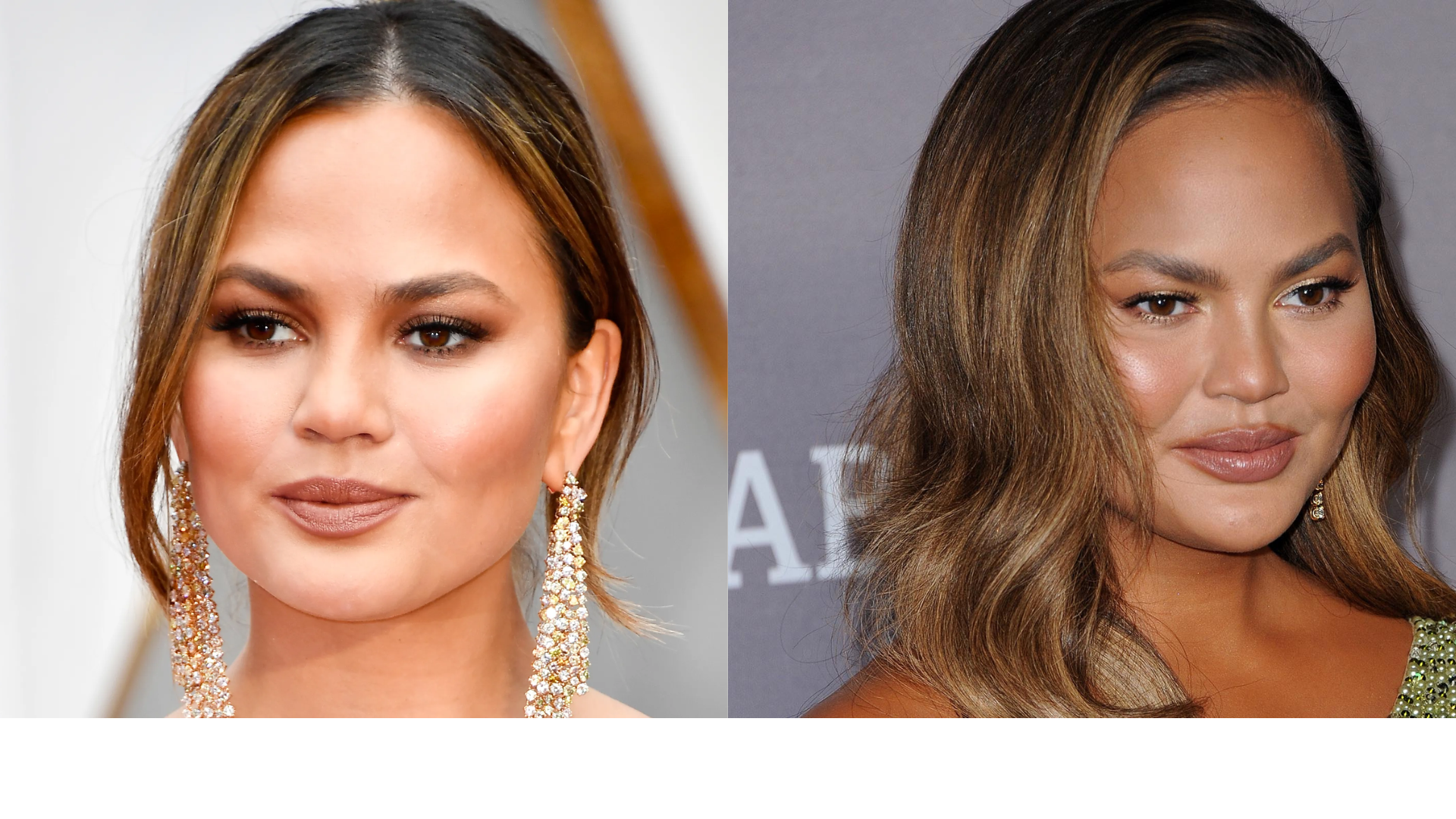 Celebrity Botox Transformations: What We Can Learn from the Stars