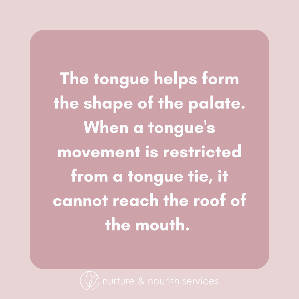 Visual Signs of Tongue Tie