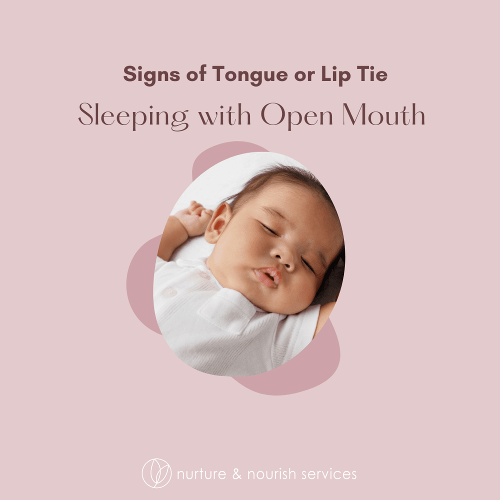 Visual Signs of Tongue Tie