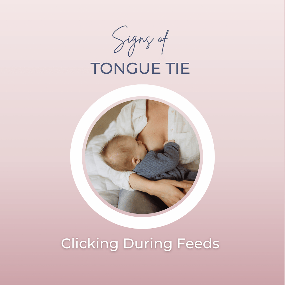 Baby Tongue Tie Ankyloglossia Lactation Consultant Charleston Sc