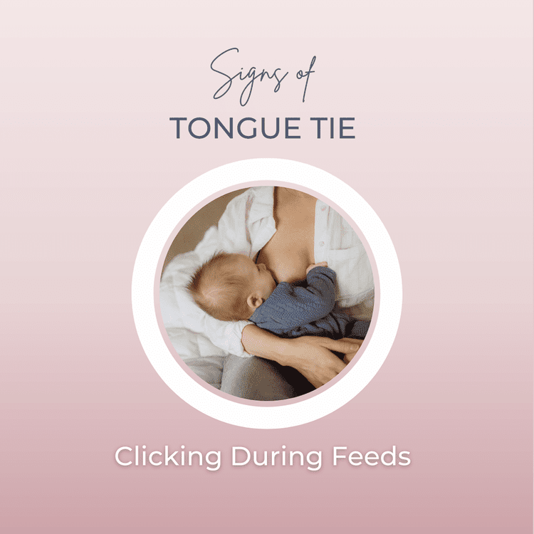 Baby Tongue Tie (Ankyloglossia) — Lactation Consultant Charleston, SC
