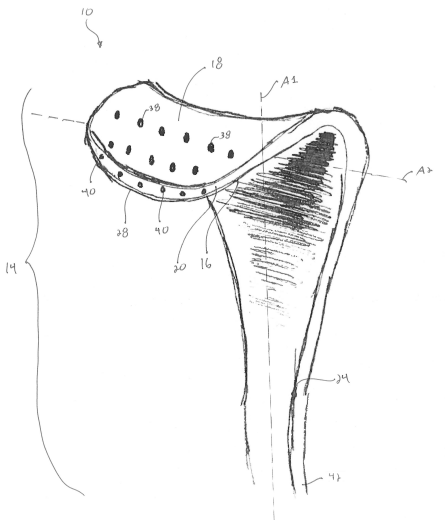 About — rinsada--irrigating lid retractor