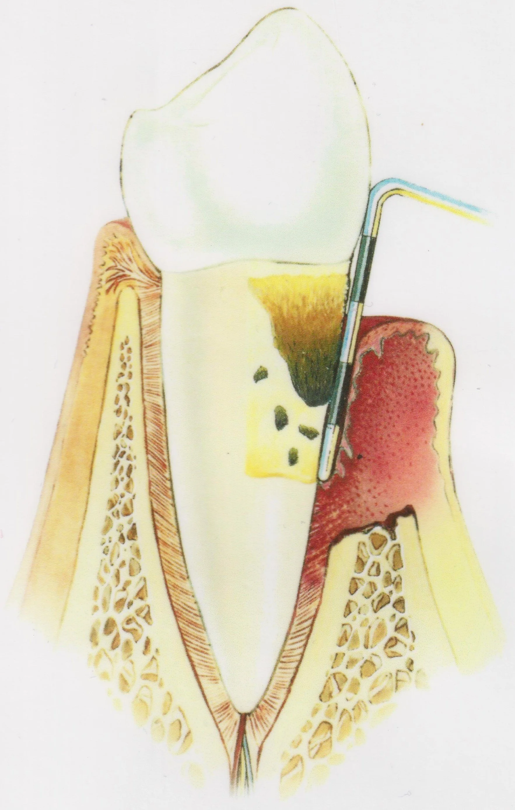 Periodontal Treatments | Enhance Your Oral Health — Book Now — Premium ...