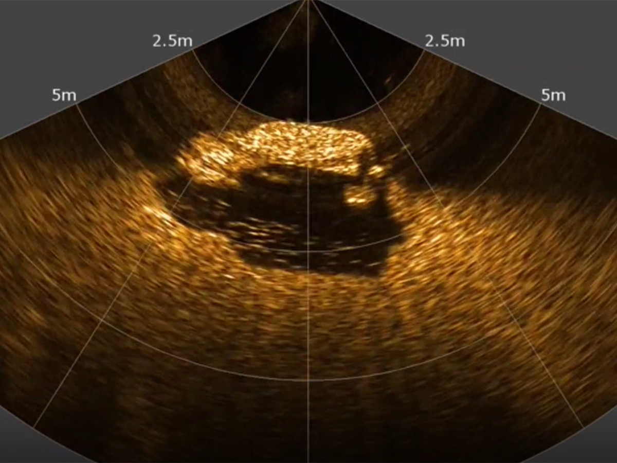 Products Overview - BUVI Scandinavia