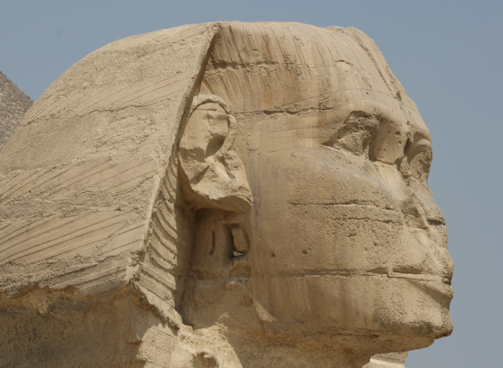 153. Facial Fractures: face it, its broken — Emergency Medicine Board ...