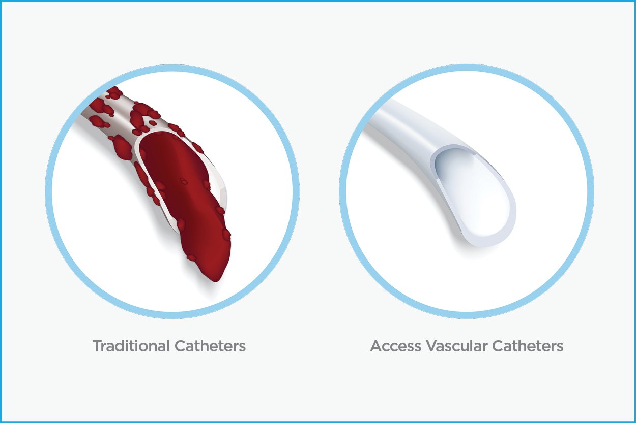 Transforming Vascular Access and Reducing Complications