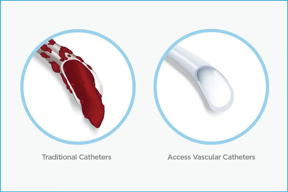 Transforming Vascular Access and Reducing Complications