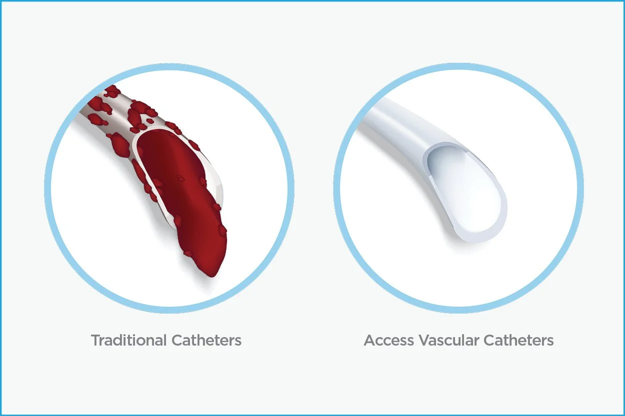 Transforming Vascular Access and Reducing Complications