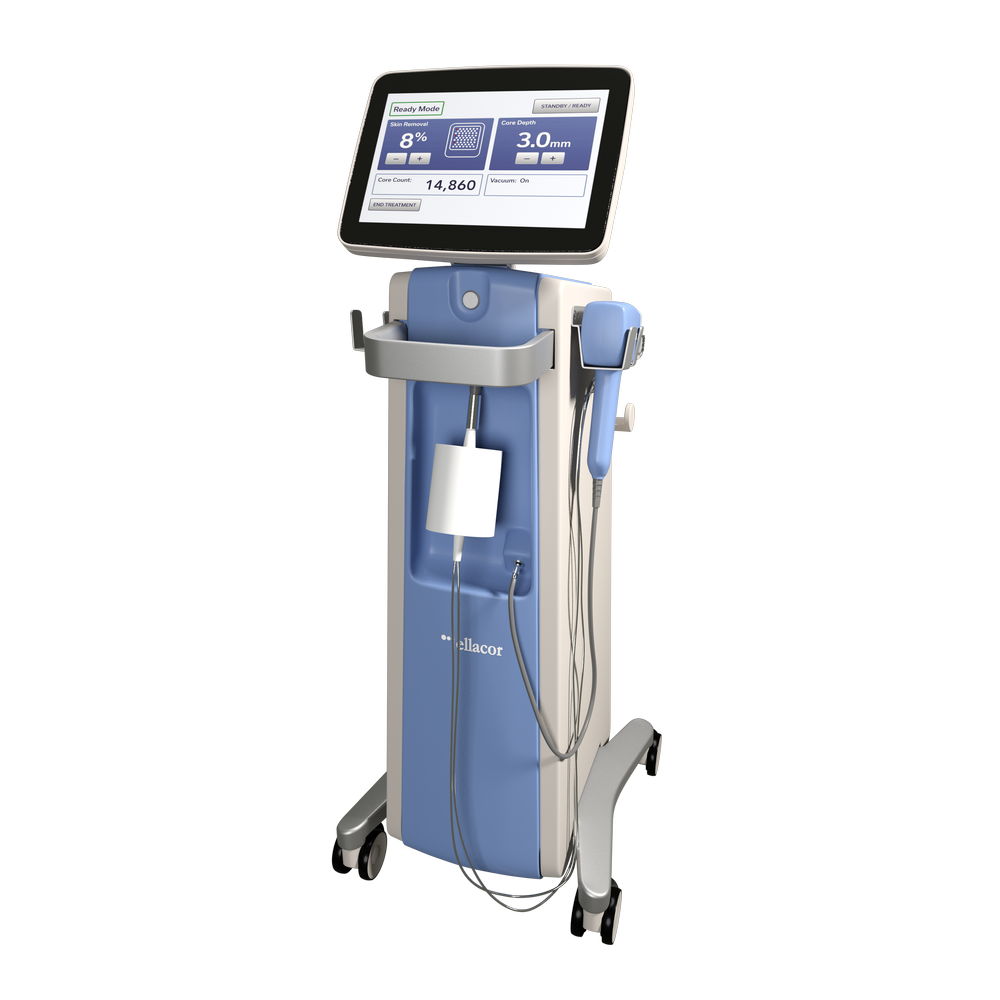 Ellacor Micro-Coring Procedure Chattanooga | Four Bridges Dermatology