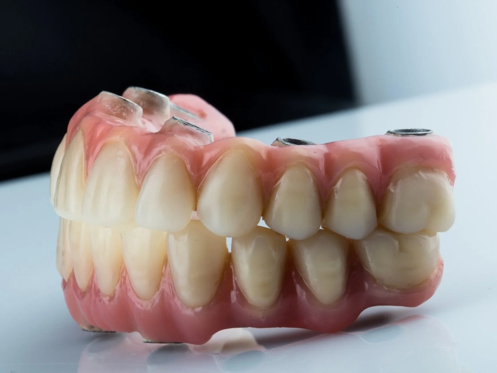 Services — Cullman Cosmetic & Family Dentist - Invisalign Dental Implant