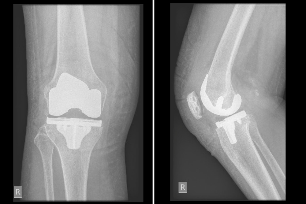 Hobart Knee Centre. Bulk Billing. Affordable Knee Surgery Tasmania