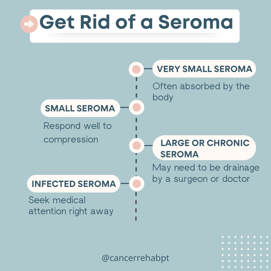 Cancer Rehab PT — Seroma After Surgery: What It Is & What to Do