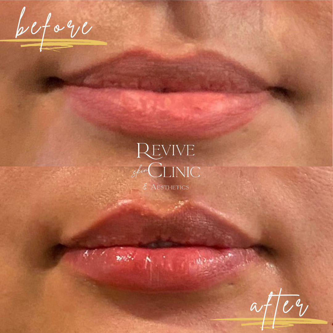 Gallery — Revive Skin Clinic