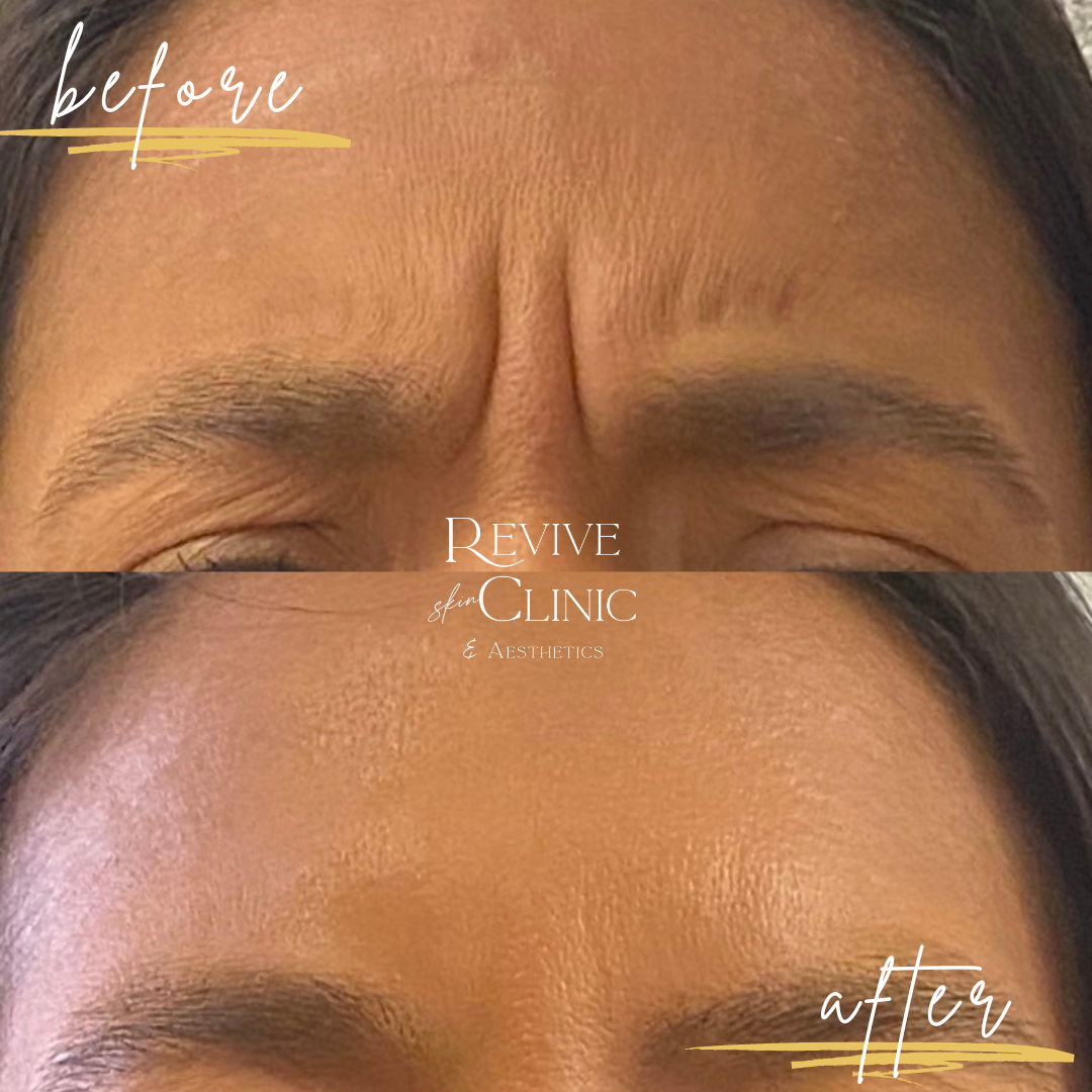 Gallery — Revive Skin Clinic