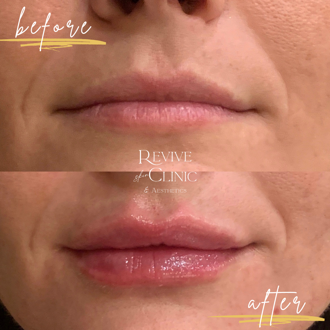 Gallery — Revive Skin Clinic