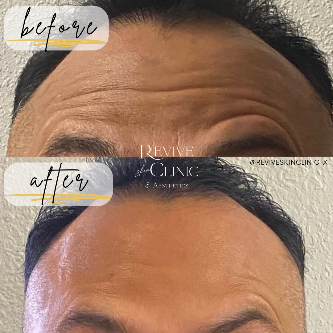 Gallery — Revive Skin Clinic