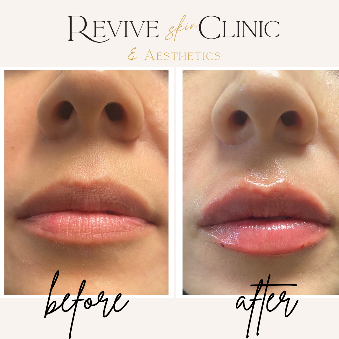 Gallery — Revive Skin Clinic