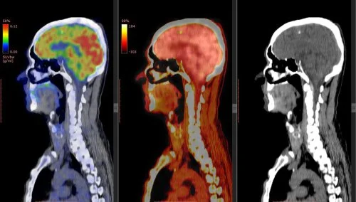 Dementia Series: Testing and Diagnosis of Cognitive Decline + Dementia ...