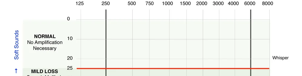 Explaining the Audiogram — Eichler Hearing Center | South Dakota