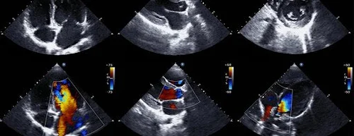 Echo... Echo... Echocardiogram — Medical Essential Diagnostic