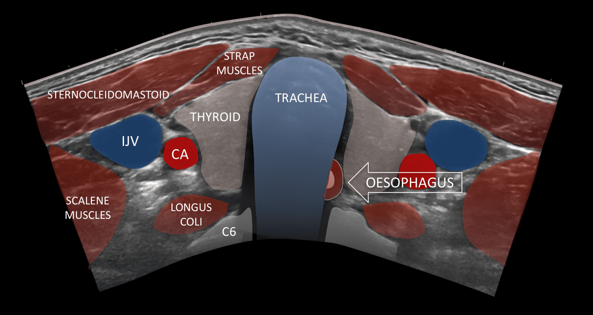 The Role of Neck Ultrasound in Diagnosing Neck Conditions — Medical ...