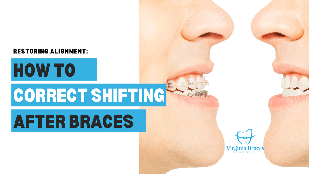 Restoring Alignment: How to Correct Shifting After Braces — Virginia Braces