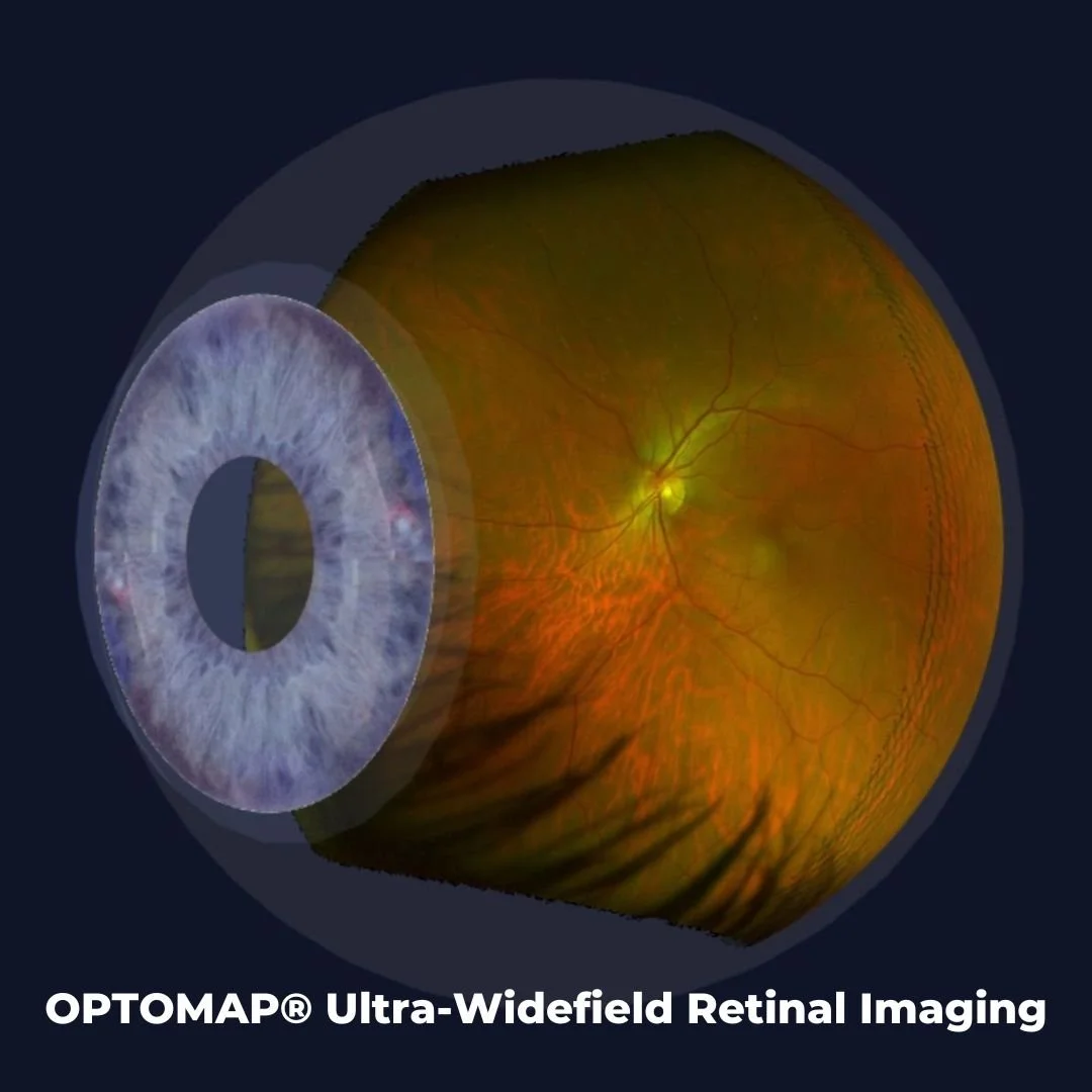 What You Need to Know About Eye Exam Coverage for Seniors 65+ in Alberta