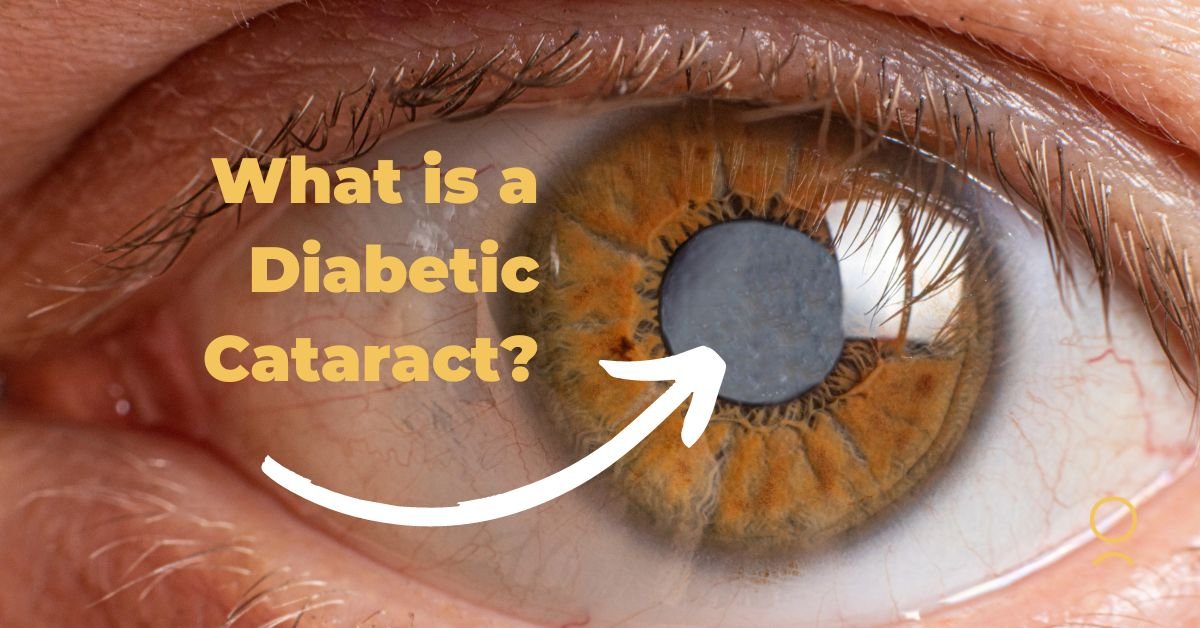 What Is A Diabetic Cataract What Is A Diabetic Cataract