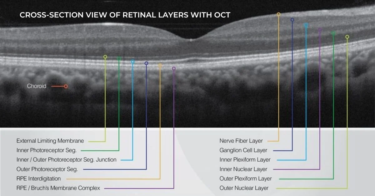 Do You Need an OCT Scan at Your Next Eye Exam?