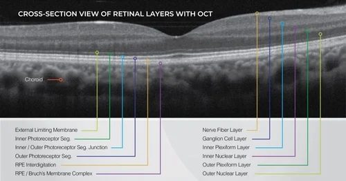 Do You Need an OCT Scan at Your Next Eye Exam?