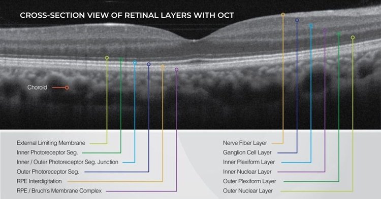 Do You Need an OCT Scan at Your Next Eye Exam?