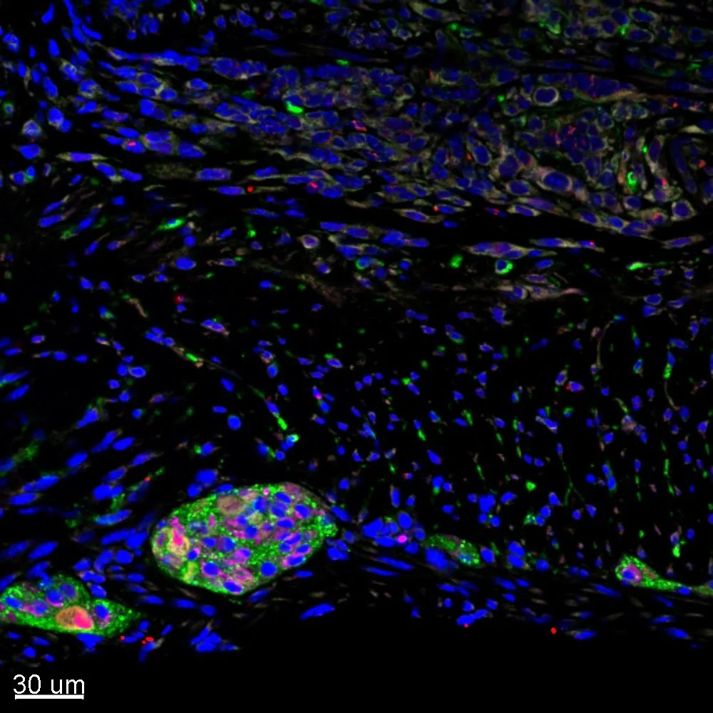 Baiwen Chen — Hua-Bing Li lab