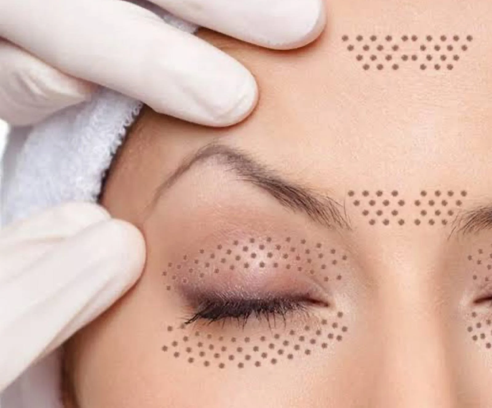 Advanced Skin Treatments — Ultimate Skin Aesthetics