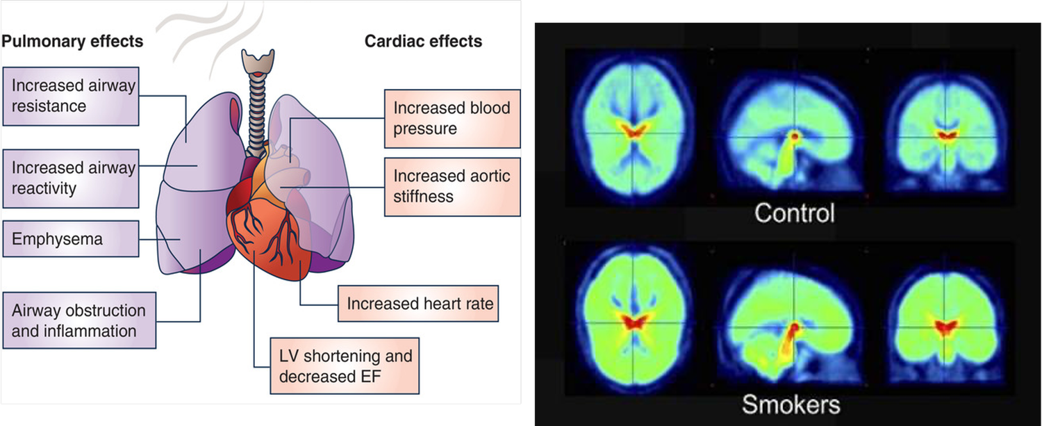 Why does smoking relax a smoker? — Lung Cancer Kilts Research Cures!