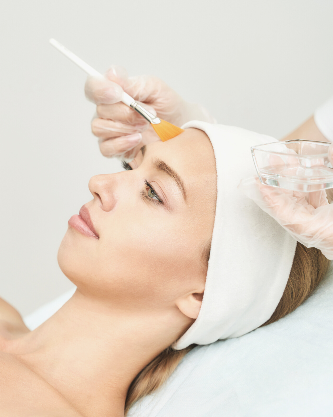 Revitalize Your Skin with PCA skin peels in London — CliniCity