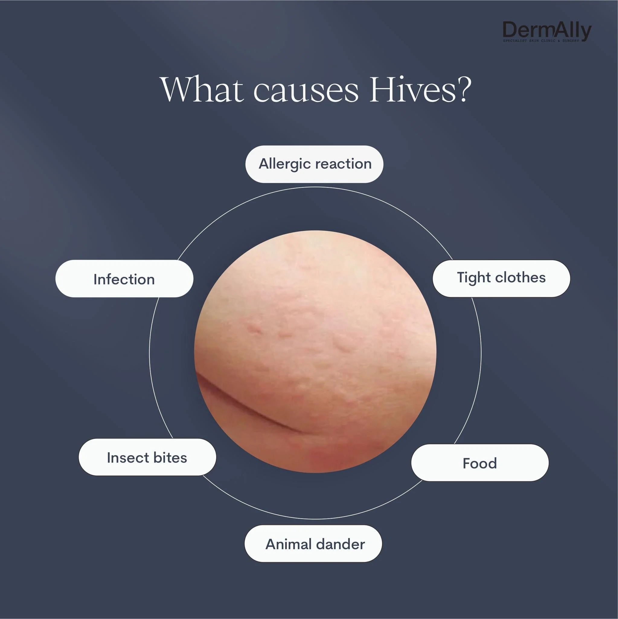 DermAlly: Specialist Skin Clinic & Surgery