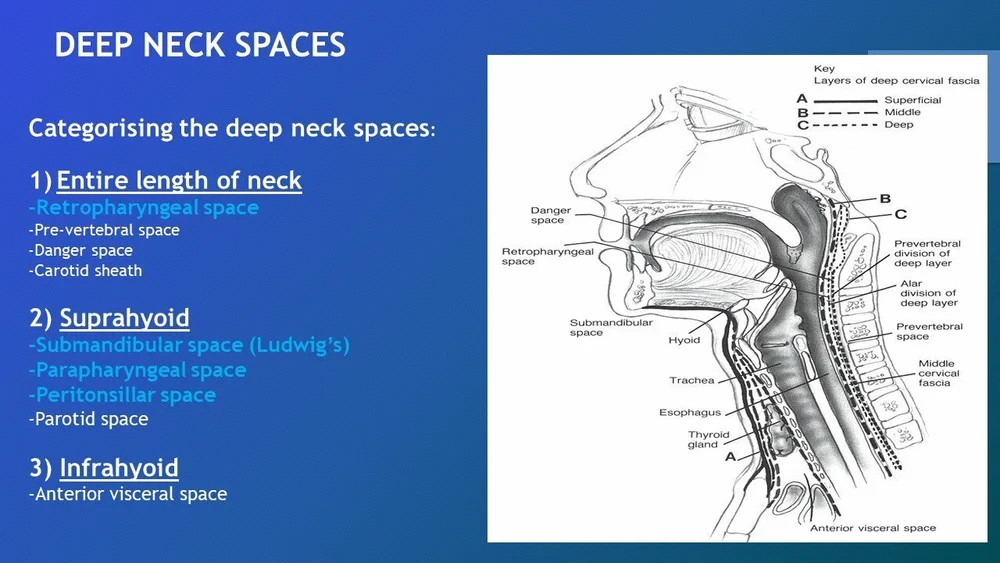 Retropharyngeal Abscess Diagram