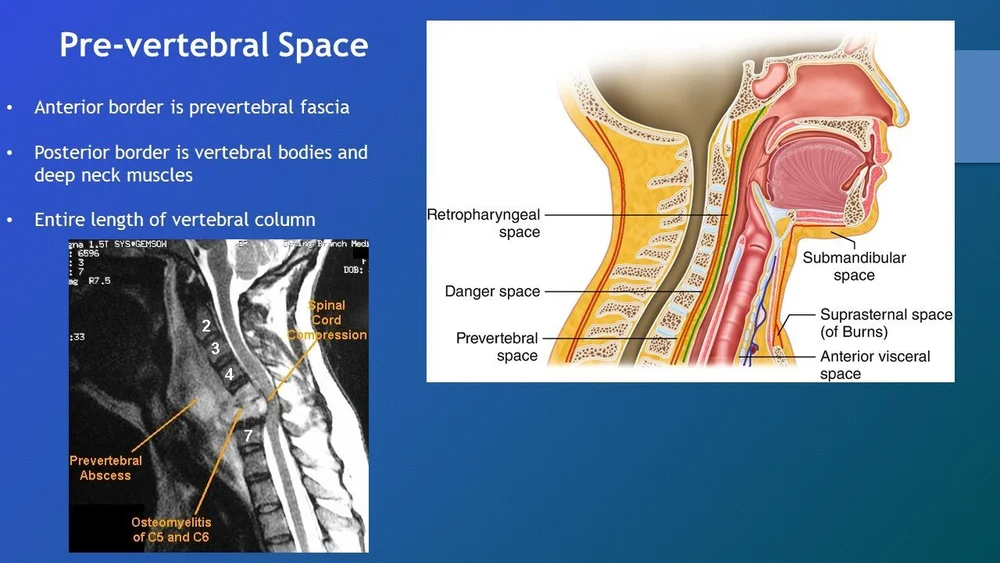 Prevertebral Space