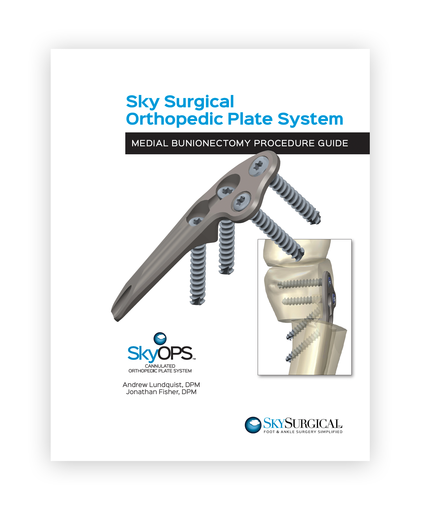 SkyOps Surgical Procedure Guides — Sky Surgical