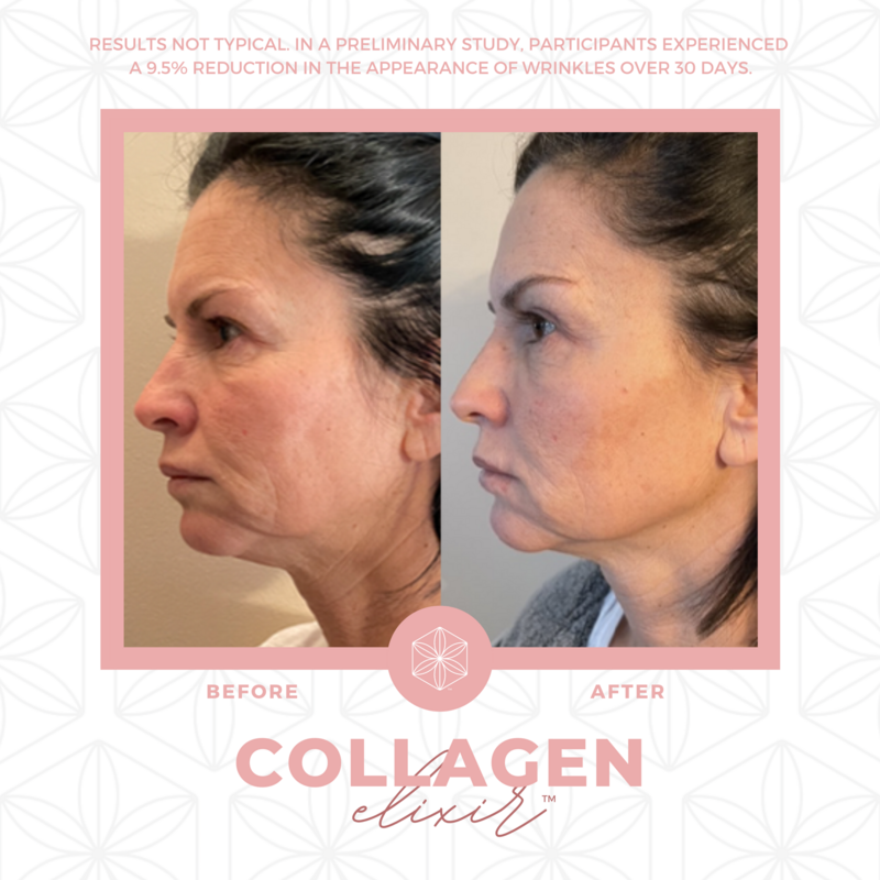 Collagen — ㅤ