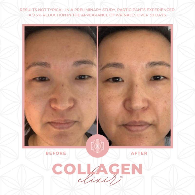 Collagen — ㅤ