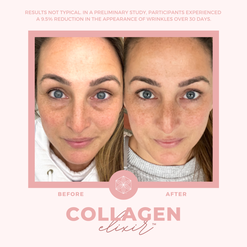 Collagen — ㅤ
