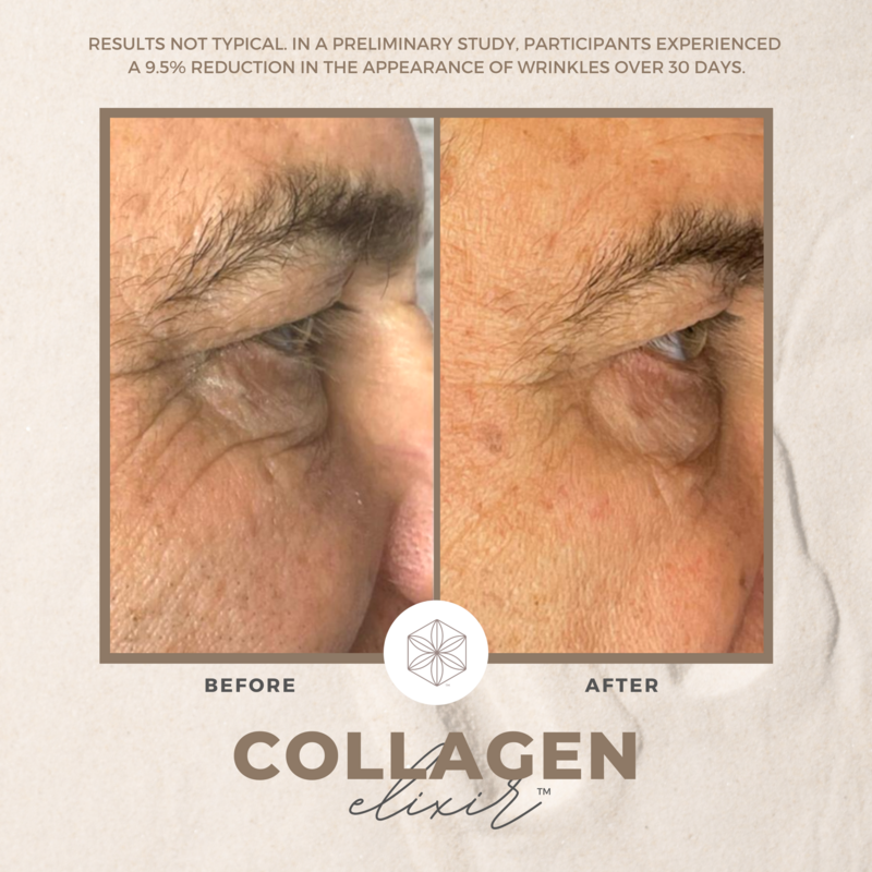 Collagen — ㅤ